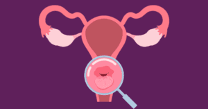 Distinguishing Between Vaginal Discharge, Arousal Fluid, & Cervical Mucus