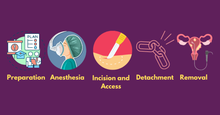 Vaginal Hysterectomy Procedure Benefits And Recovery
